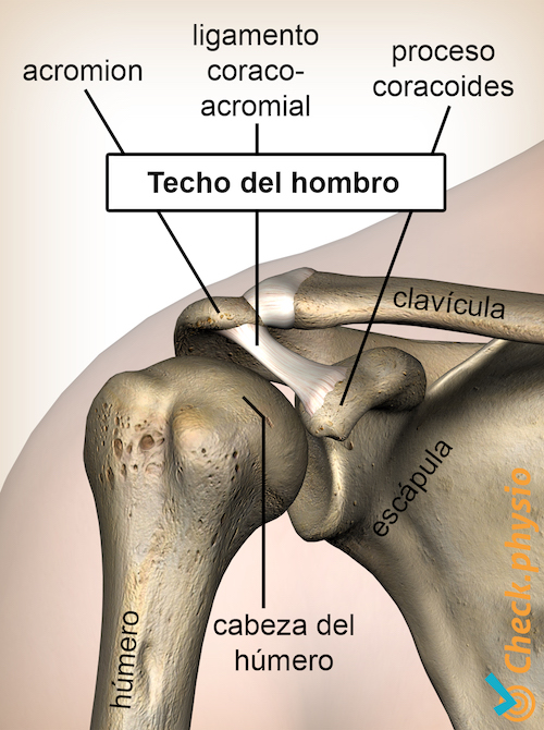 Síndrome subacromial | Causa, síntomas y tratamiento